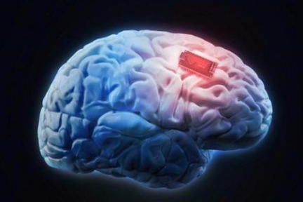 “随芯所欲”的脑芯片，究竟是人脑增强仪还是定时引爆器？-36氪