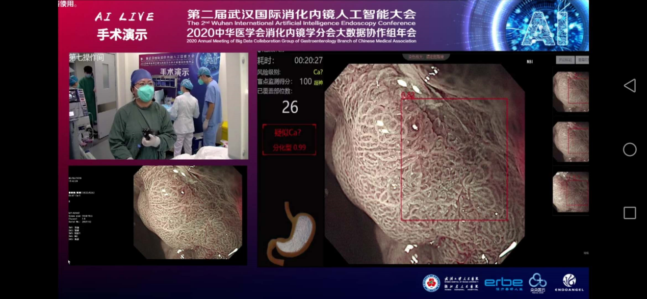 内镜精灵Endoangel——内镜医师的第三只眼，消化内镜人工智能解决方案产品获批医疗器械注册证-36氪