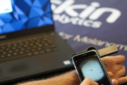 「Skin Analytics」获 400 万英镑 A 轮融资，用 AI 技术筛查皮肤癌-36氪