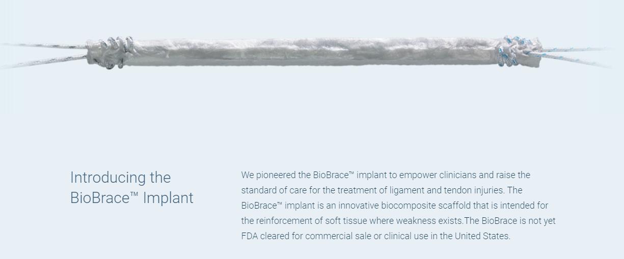 医疗器械公司「Biorez」获 350 万美元种子轮融资，改善肌腱和韧带的修复过程-36氪