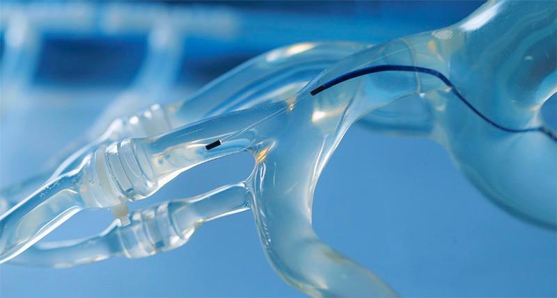 瑞士医疗科技公司NanoFlex Robotics利用磁导航专利技术，研发新型介入式手术设备治疗急性中风 | 瑞士创新100强-36氪