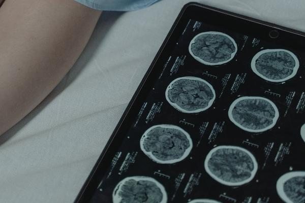 海外 New Things | Radionetics Oncology获5250万美元A轮融资，研发针对癌症的放射性药物-36氪