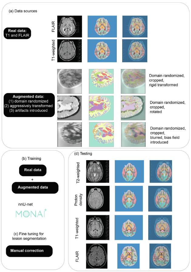 最大化挖掘临床MRI数据价值，UCL团队提出MindGlide模型，实现多发性硬化症病变量化-36氪